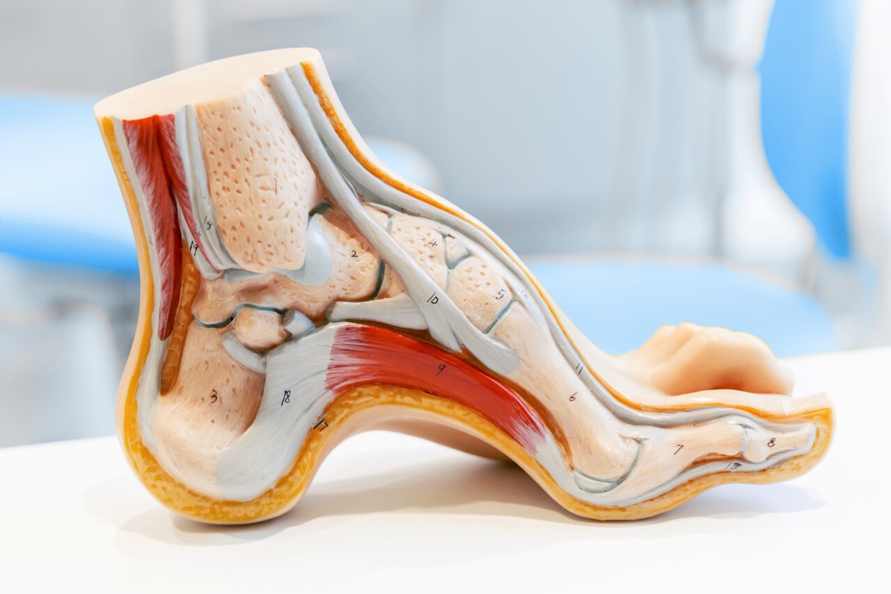 Hohlfuß | ORTHO | PEDE Zentrum für Fuß und Sprunggelenk
